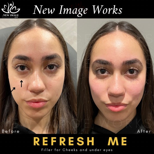 Refresh Me – New Image Works