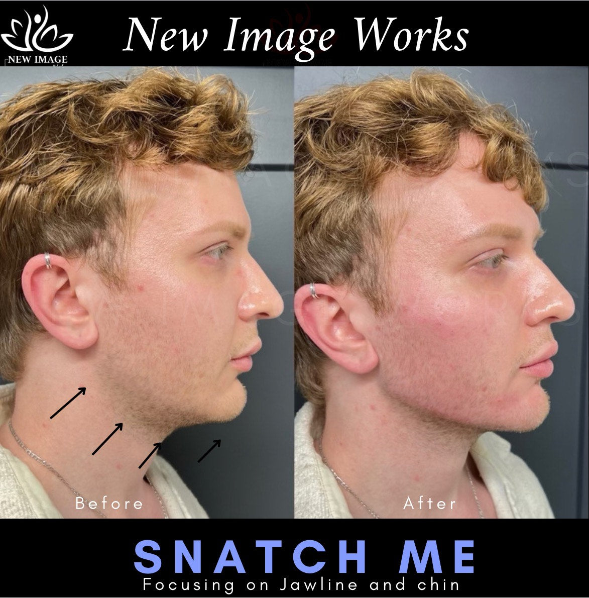 Snatch Me – New Image Works
